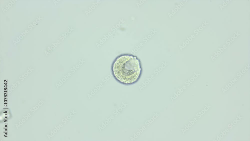 Larva sea urchin Strongylocentrotus pallidus under microscope, phylum ...