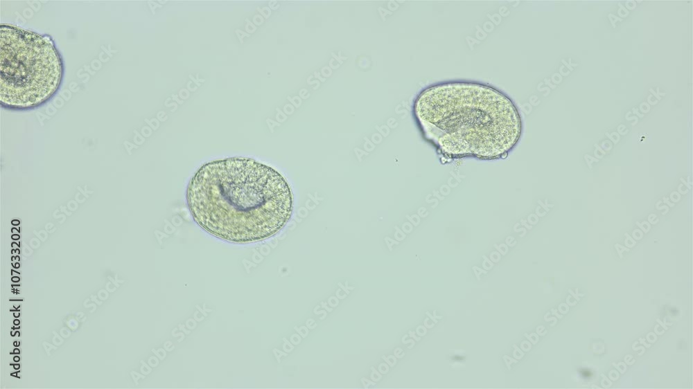 Larvae sea urchin Strongylocentrotus pallidus under microscope, phylum ...