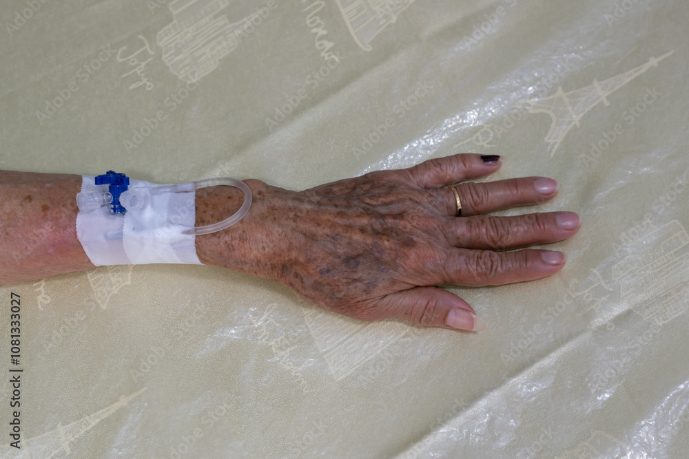 Catéter venoso periférico. Dispositivo para extraer sangre y ...