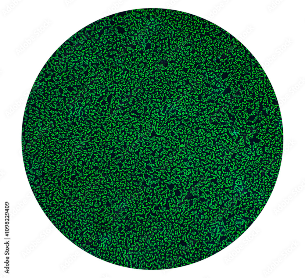 Salmonellosis. Microscopic view of gram stained slide from blood agar ...