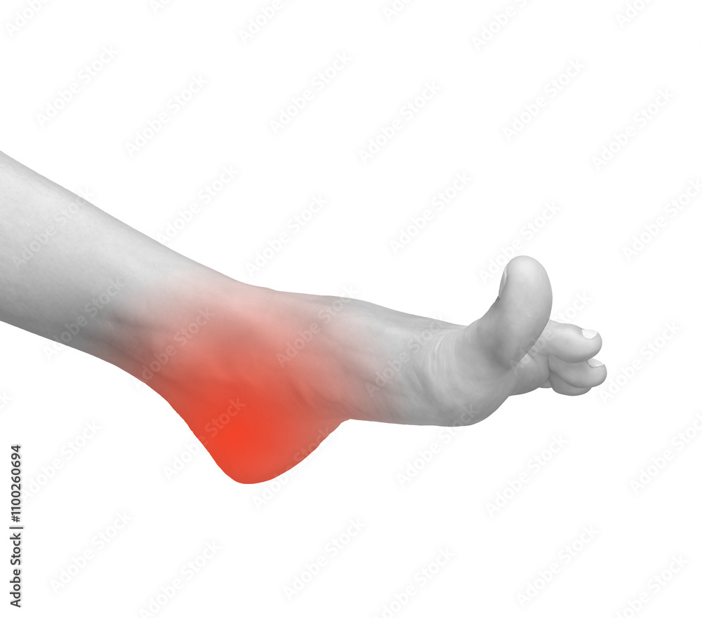 Foot pain and inflammation. Sore heel and joint injury causing chronic ...