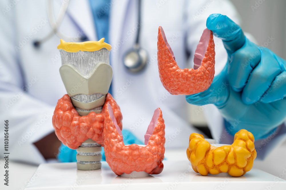 Poster Hyperthyroidism, Overactive Thyroid, Thyroid Lymphoma, Asian ...