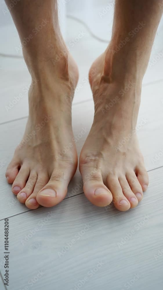 Sore skin on the legs. A man scratches his feet with his hands. A man's ...