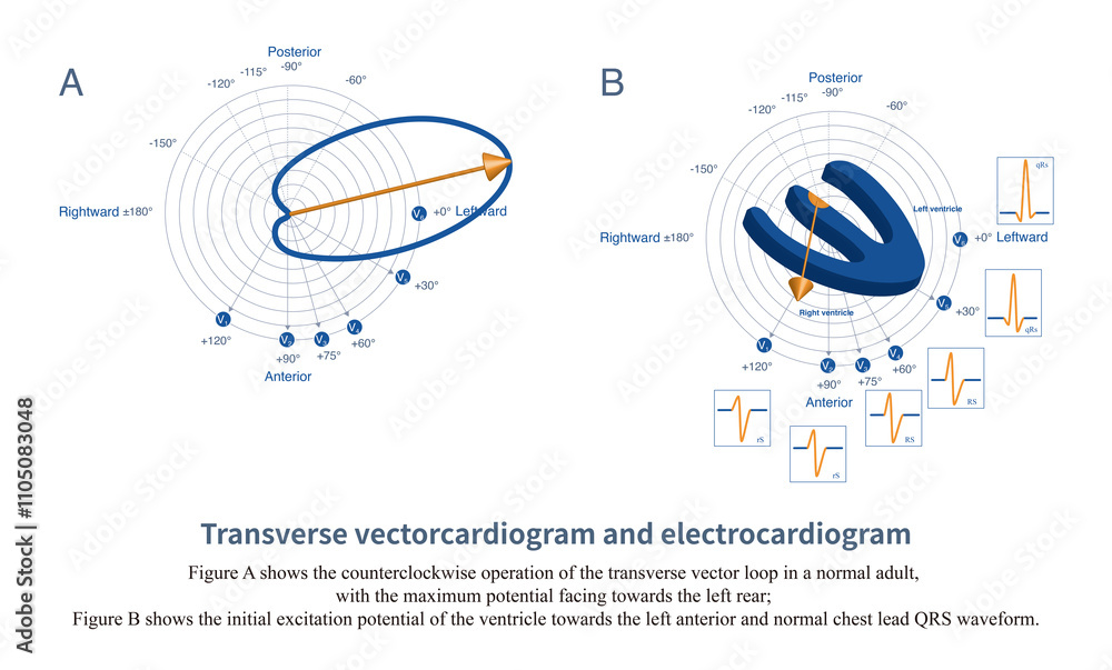 The transverse vectorcardiogram generates a chest leads ...