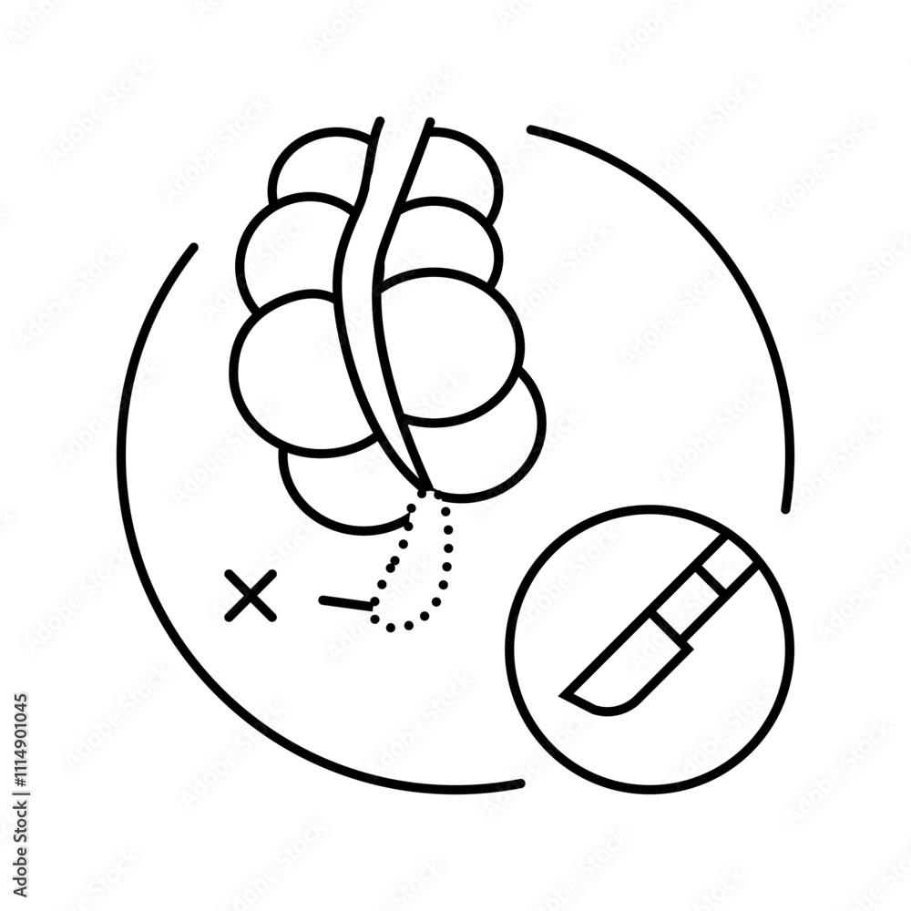 appendectomy surgery doctor line icon vector. appendectomy surgery ...