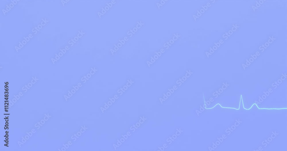 ECG graph of atrial fibrillation, 3d animation render vídeo de Stock ...