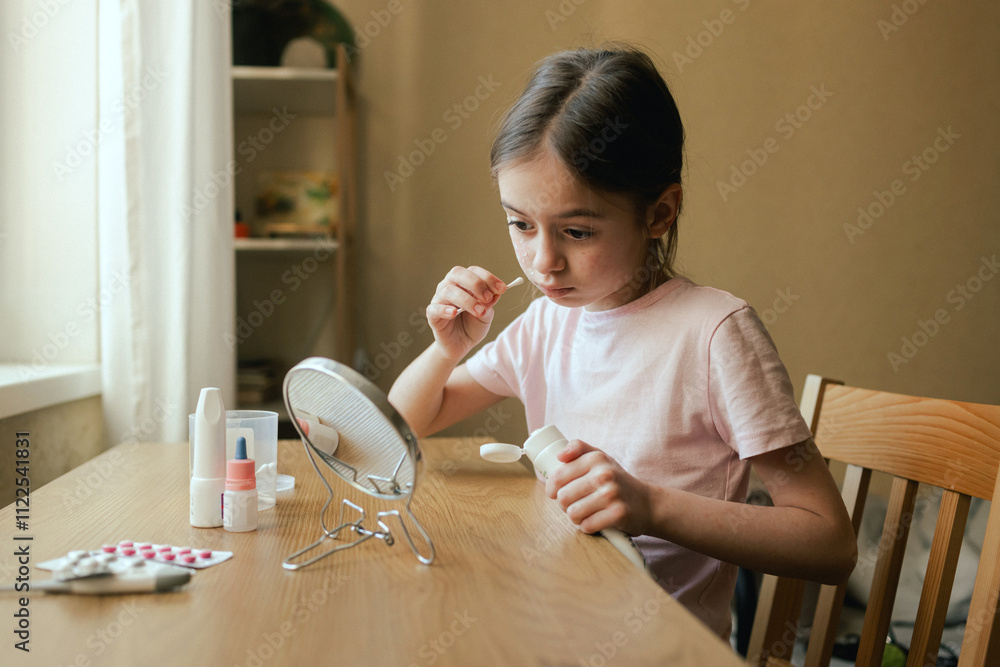 Teen girl with a rash on her face applies cream to her skin in front of ...