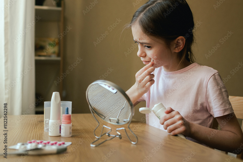 Teen girl with a rash on her face applies cream to her skin in front of ...