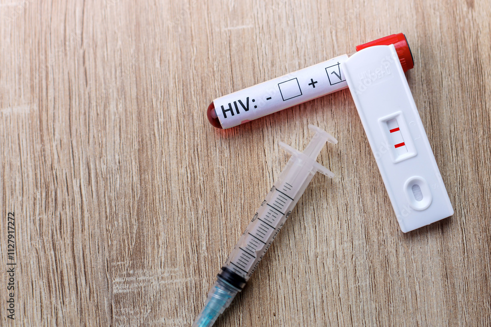 HIV Test Kit On Test Tube With Blood Plasma And Syringe Stock Photo ...