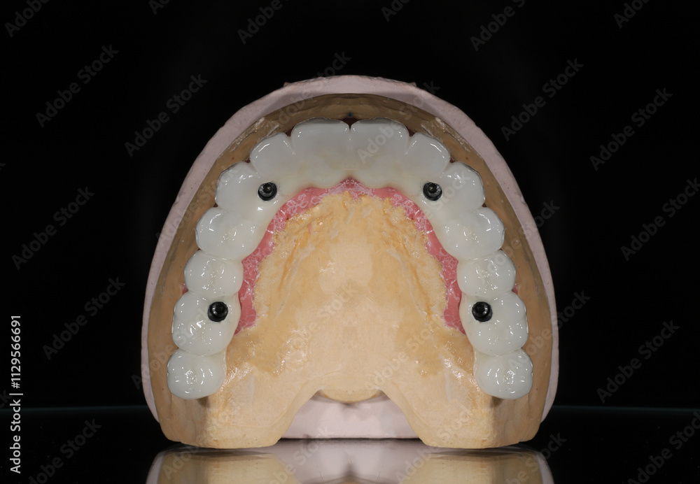Full-arch dental prosthesis torque wrench and dental implant wrench ...