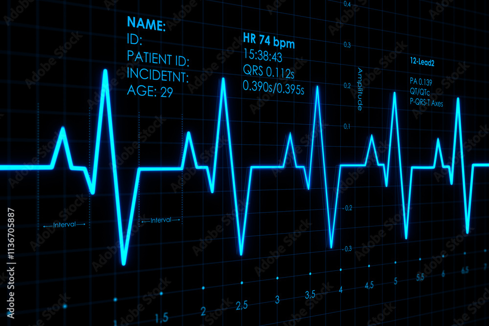Cardiology concept with blue digital heart rate chart and personal ...