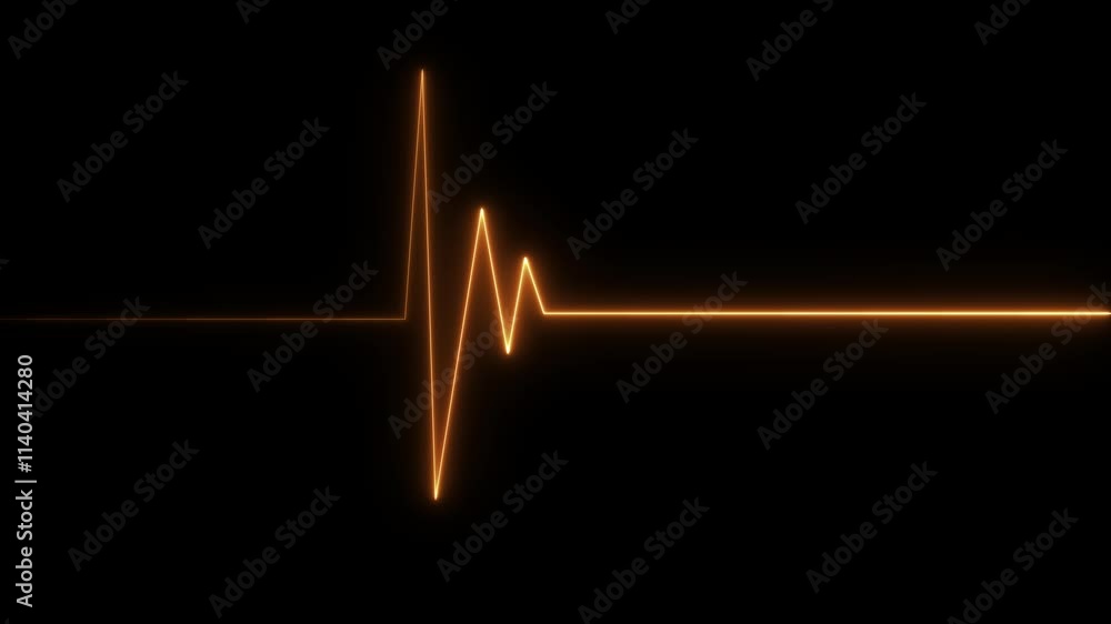 GIF Animation of an ECG showing atrial fibrillation. ECG exhibiting ...