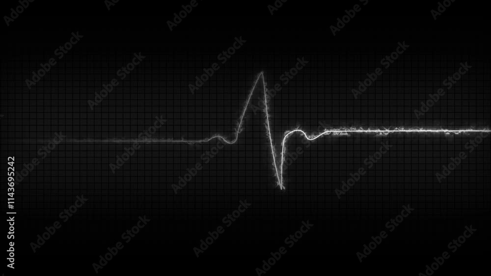 Glowing Heartbeat line icon animation. Heartbeat line showing ...