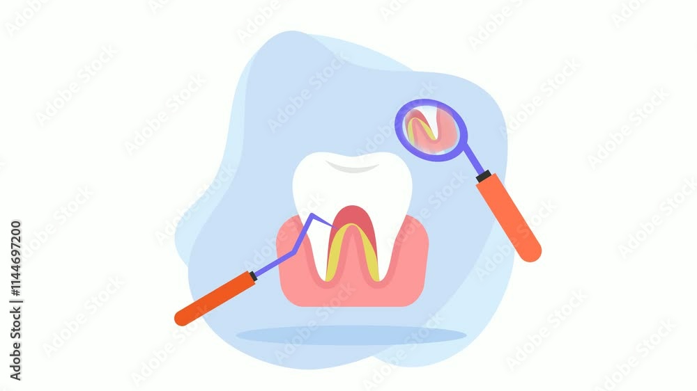 Gingivitis Exam using Mouth mirror animation, Tender, discolored or ...