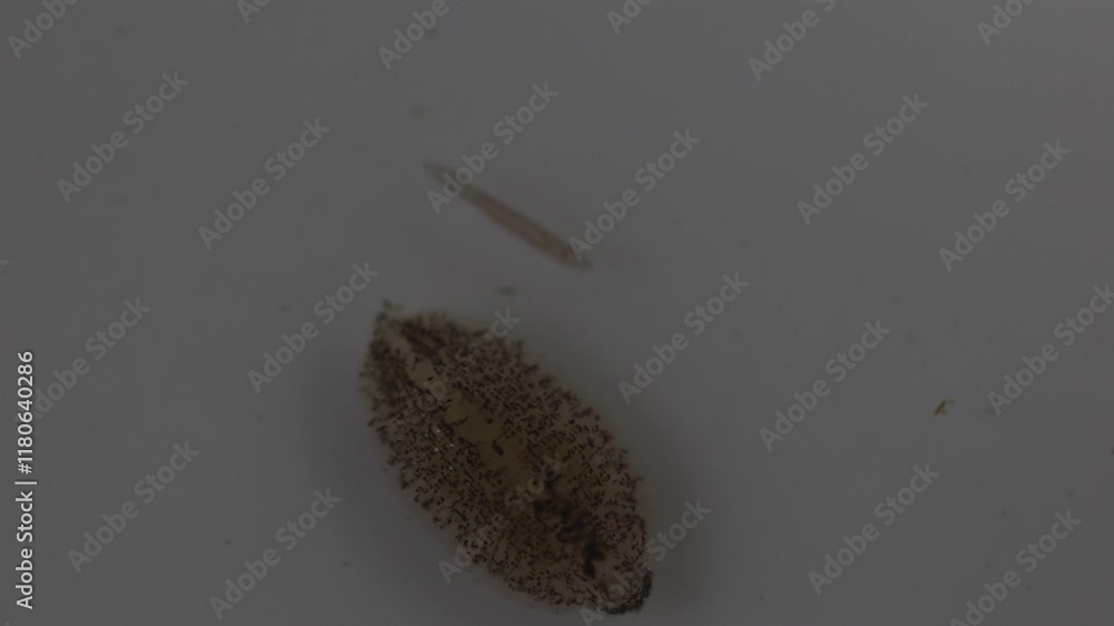 Leeches are segmented worms that belong to the phylum Annelida and ...