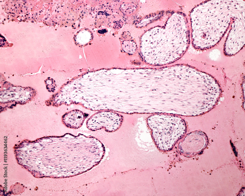 Poster Human placenta. Mole of Breus – Wall Art | UkPosters