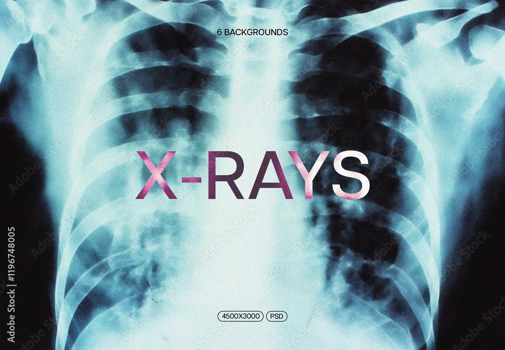 X-Ray Backgrounds With Generative AI Stock Template | Adobe Stock