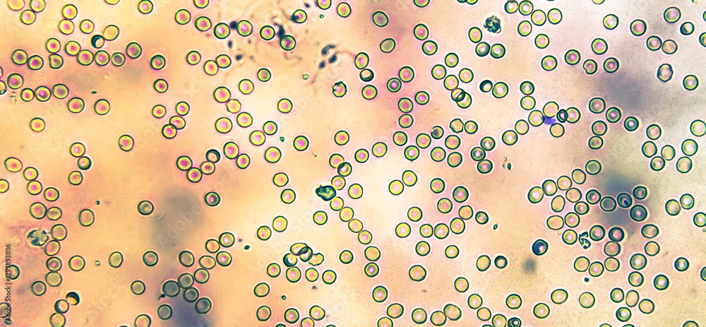 Poster Red blood cells (RBC) erythrocytes microscopic image. – Wall Art ...