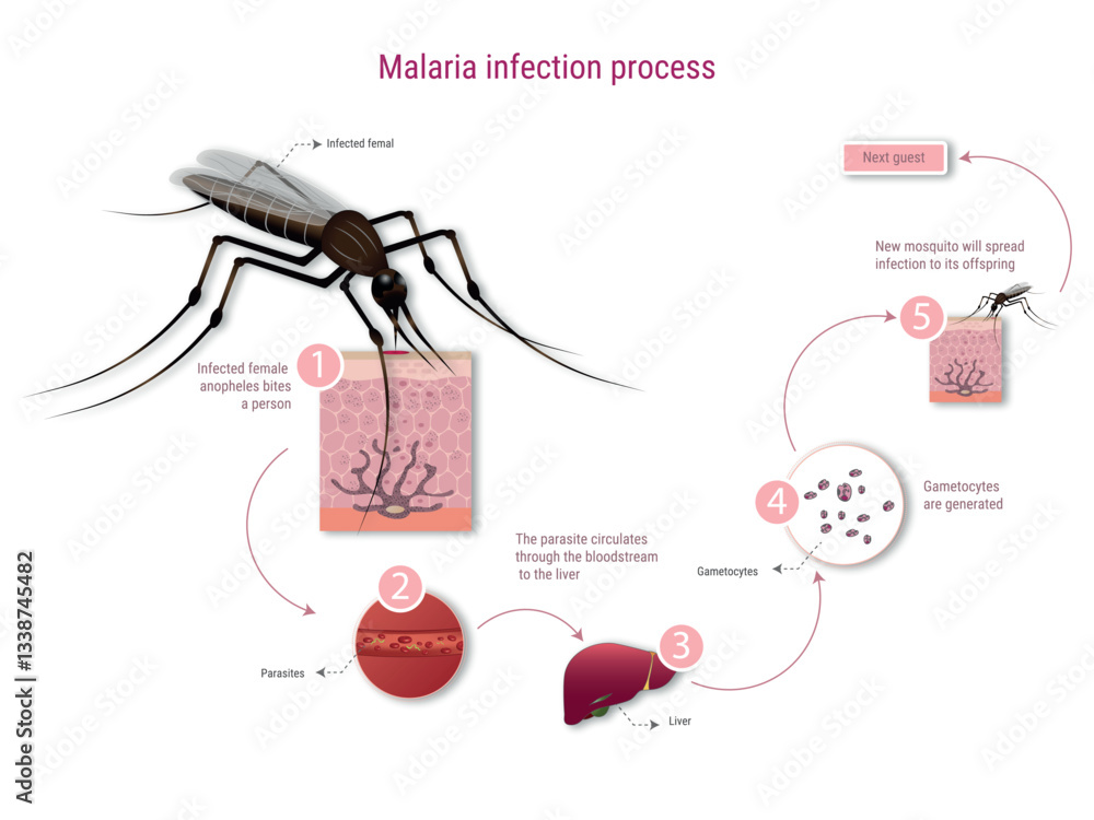 Poster Malaria infection process explained with mosquito biting person ...