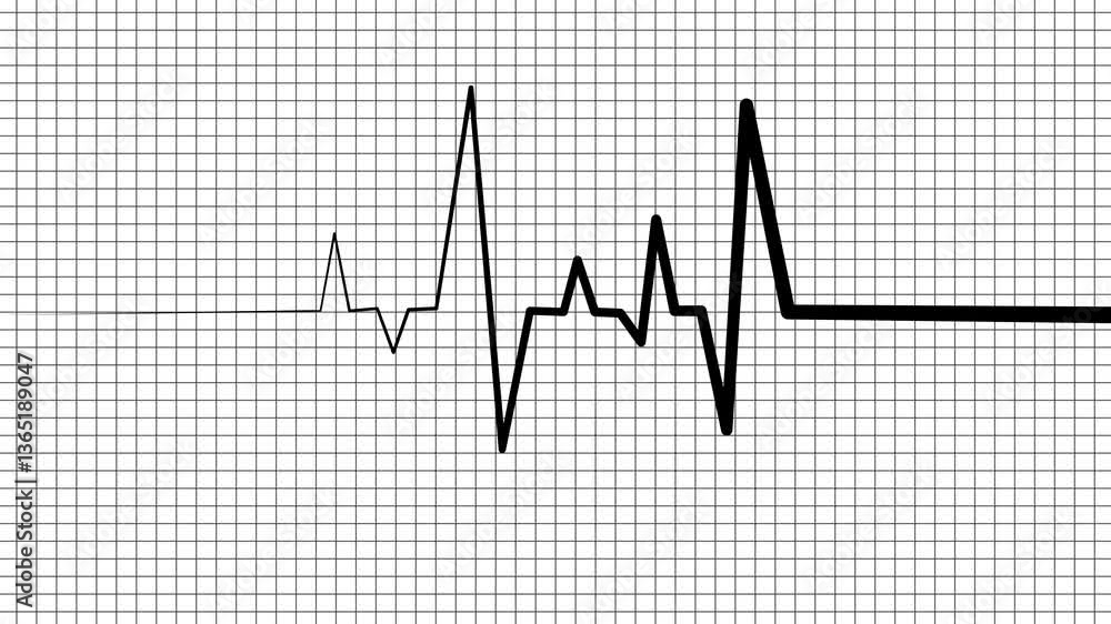 Abstract Electrocardiogram Line on Grid Animation, An abstract ...