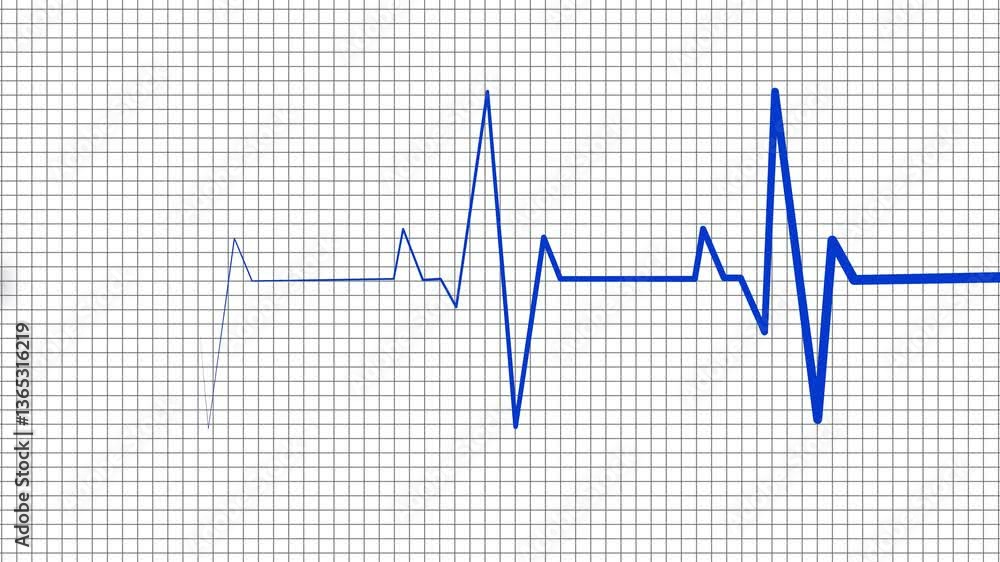 Electrocardiogram Line Animation, A electrocardiogram (ECG) line on a ...