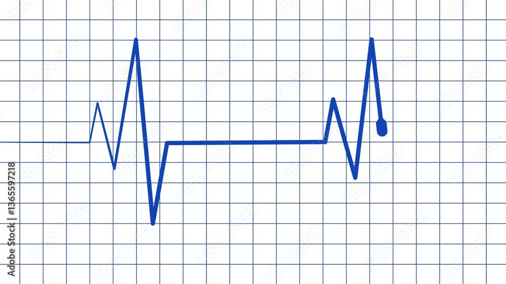 Electrocardiogram Heartbeat on Grid Background Animation ...