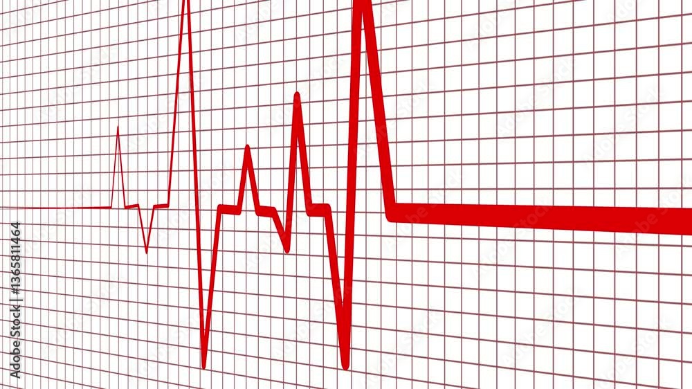 Vídeo do Stock: ECG Heartbeat Line Graph on Grid Background Animation ...