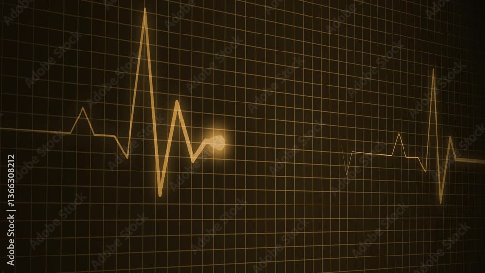 Digital ECG Heartbeat Display Animation, A digital electrocardiogram ...