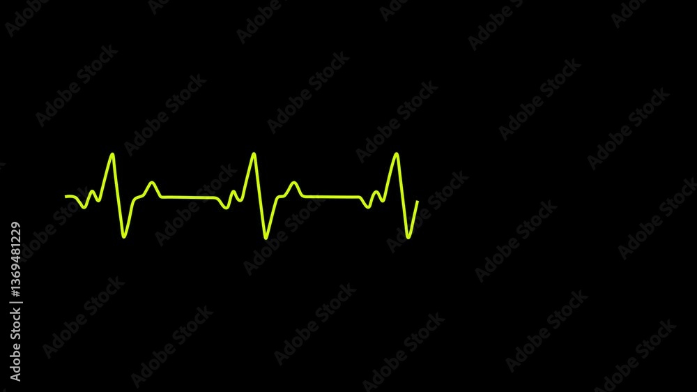 heartbeat line icon animation, Pulse Trace, Monitor. yellow color ...