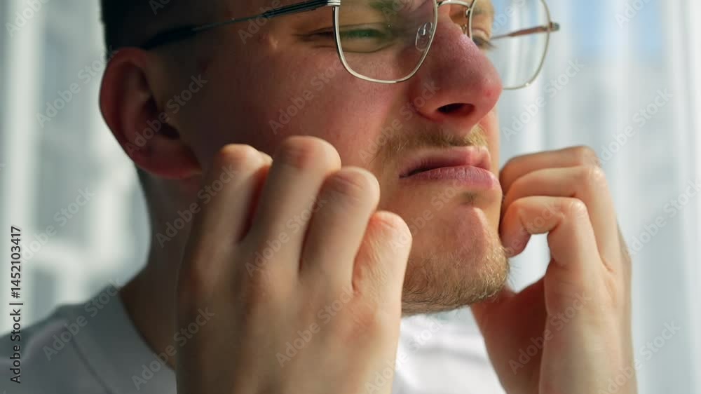 A man scratches his face during the day in sunny weather. Skin rashes ...