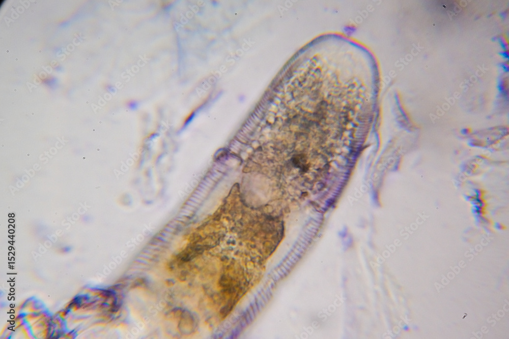 Poster demodex face mite body parts under the microscop – Wall Art ...