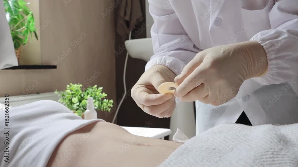 A nurse applies a base to a patient's abdomen to accommodate a ...