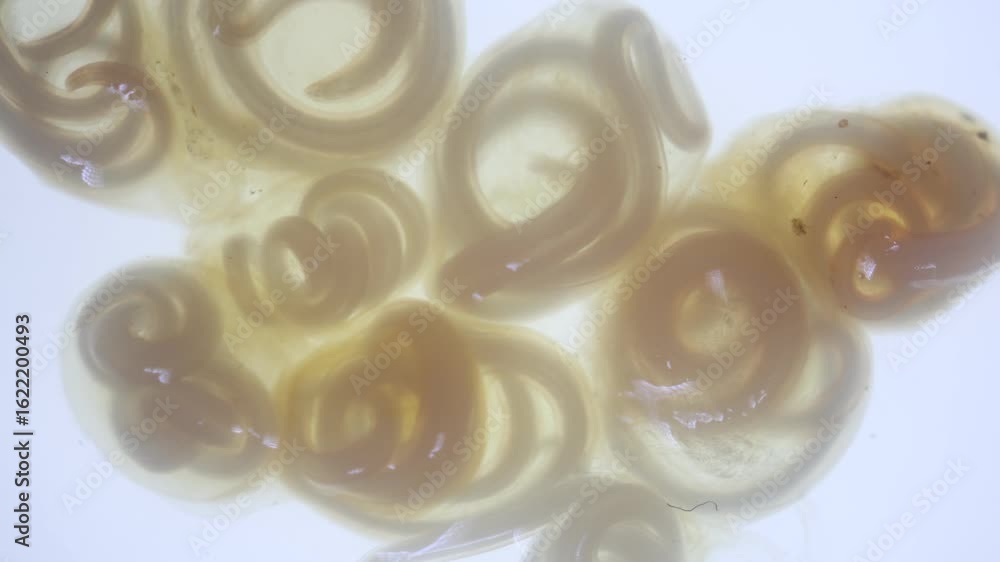 The nematodes (Nematoda), roundworms or eelworms constitute the phylum ...