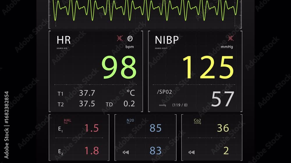 Dynamic Medical Monitor Display: ECG, HR, NIBP, Temperature, SpO2, and ...