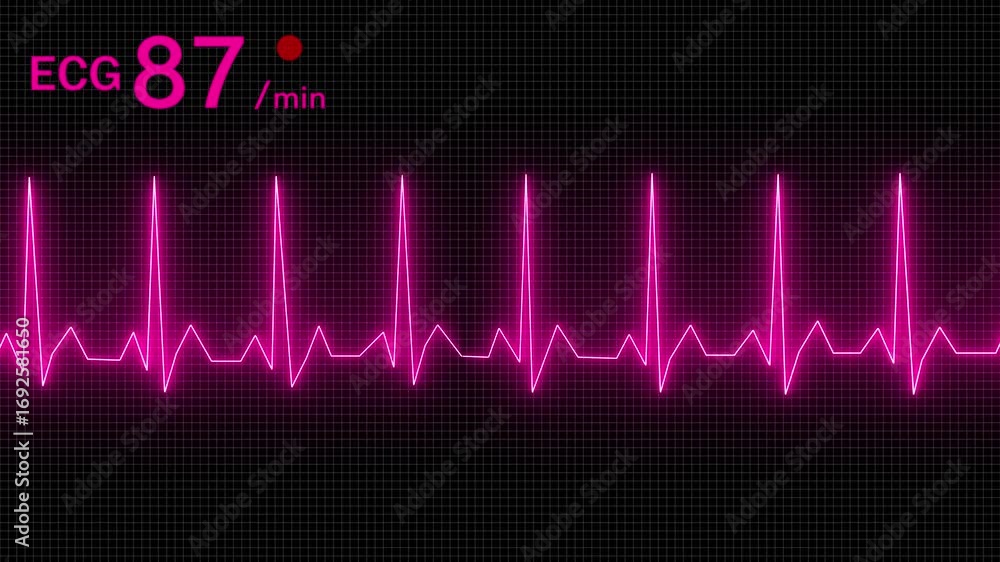 Medical ECG Heart Beat Screen Monitor Animation ,Electrocardiogram ...