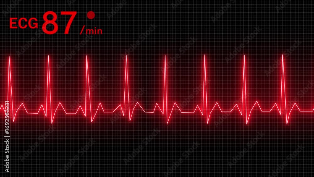 Medical ECG Heart Beat Screen Monitor Animation ,Electrocardiogram ...