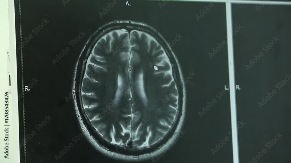 A detailed view of a chest CT scan displaying cross-sections of the ...