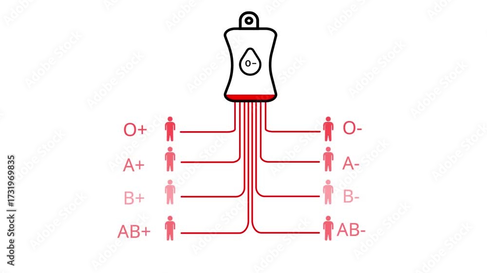 Blood Donation Compatibility Chart Showing O- Blood Bag and Recipient ...