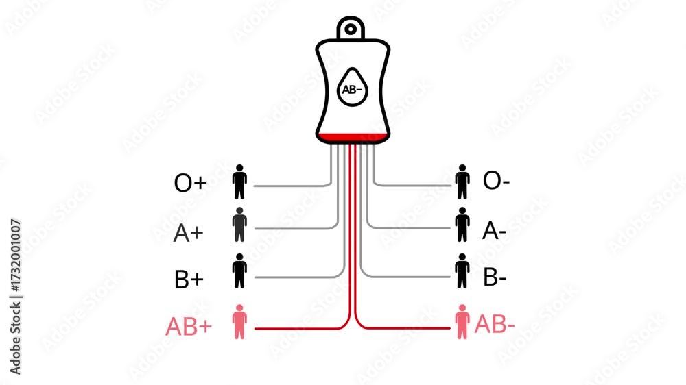 Blood Donation Compatibility Chart Showing AB- Blood Bag and Recipient ...