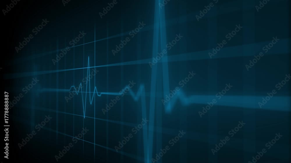 Blue EKG heartbeat line pulses on a grid background, simulating a ...