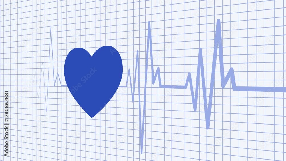 ECG Line Animation in Flat Minimal Medical Monitor Display for Motion ...