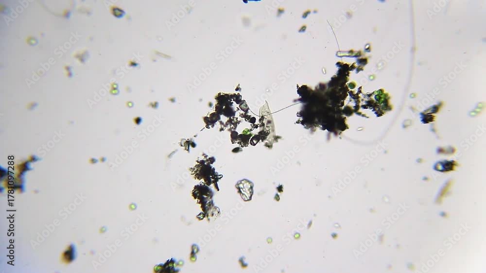 Microbes, cyanobacteria and marine protozoan in a water drop under ...