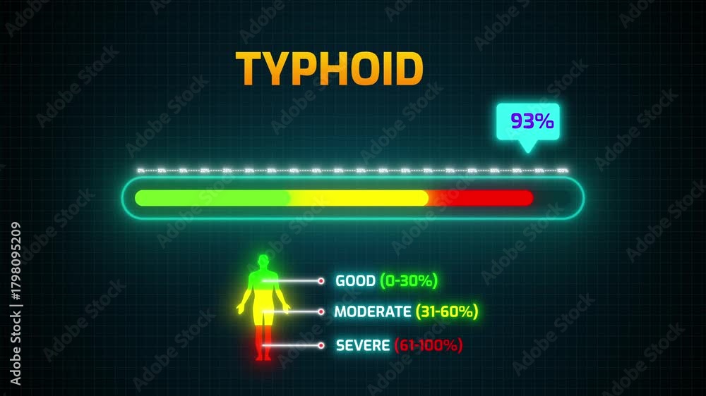 Typhoid Severity Risk Meter Animation | Digital HUD with Percentage ...