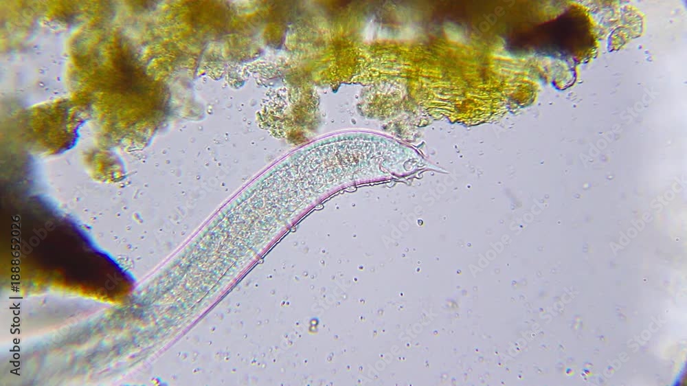 Posterior region of a nematode under 400x brightfield microscopy. 4K ...