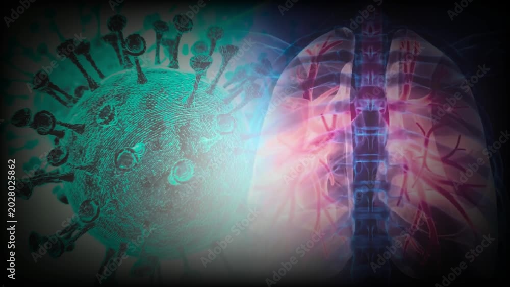 Hantavirus Pulmonary Syndrome Outbreak Concept. Microscopic Virus ...
